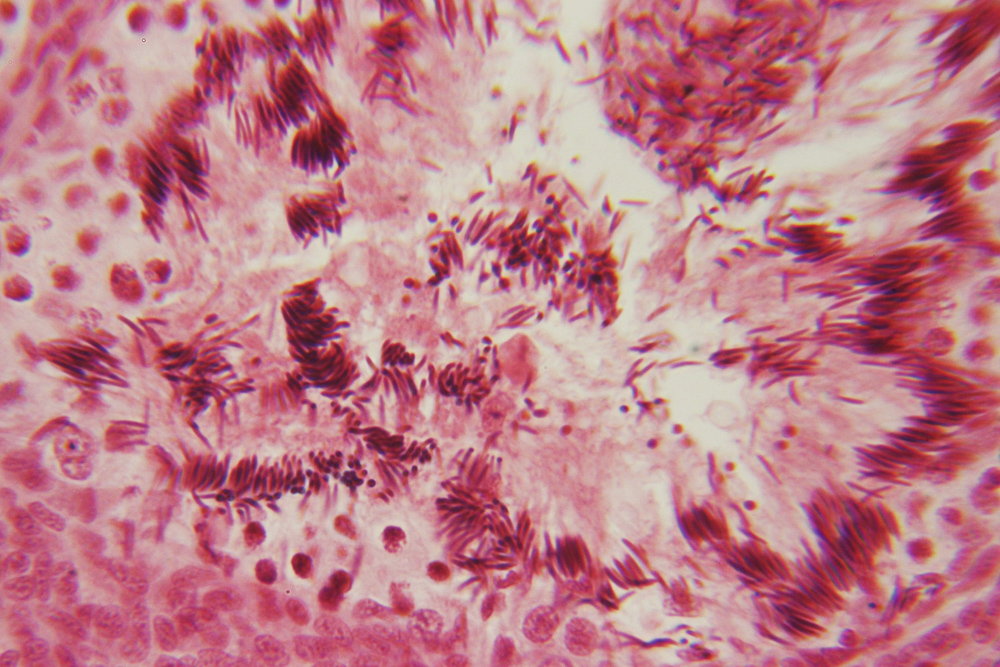 Testis, Frog – A Dove in the Bell Jar